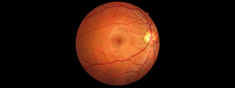 Instituto Oftalmológico Integral: Cirugía de retina